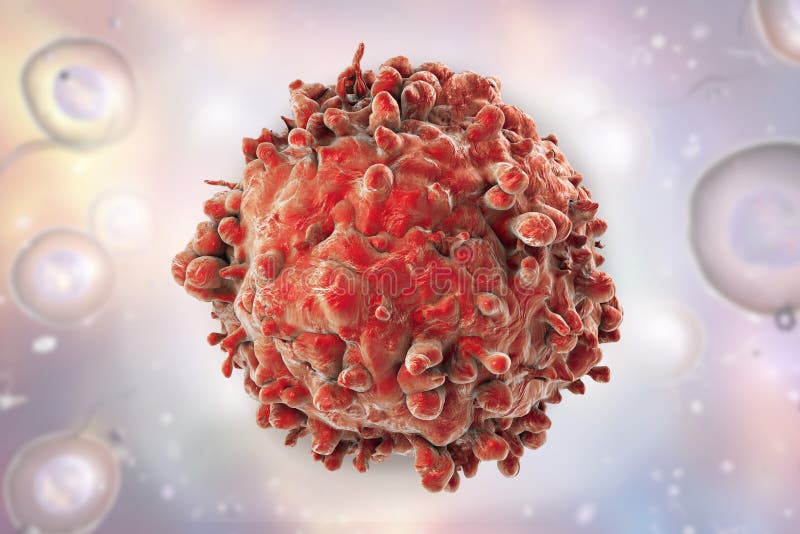 Glóbulo Branco Na Mancha Do Sangue Imagem de Stock - Imagem de mancha ...