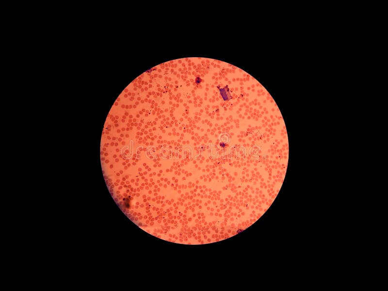 Glóbulos Bajo El Microscopio Foto de archivo - Imagen de generado ...