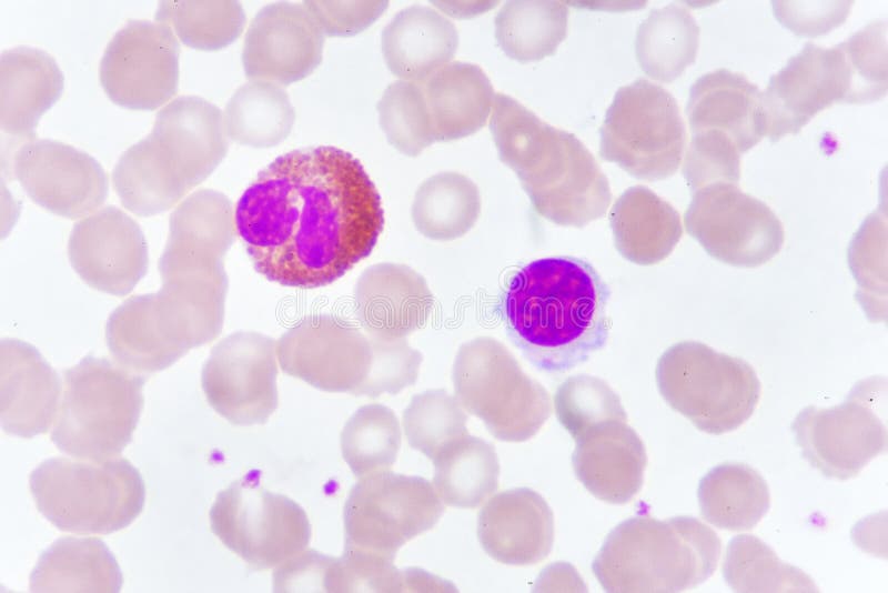 Glóbulos Brancos De Um Ser Humano, Panorama Do Photomicrograph Como U ...