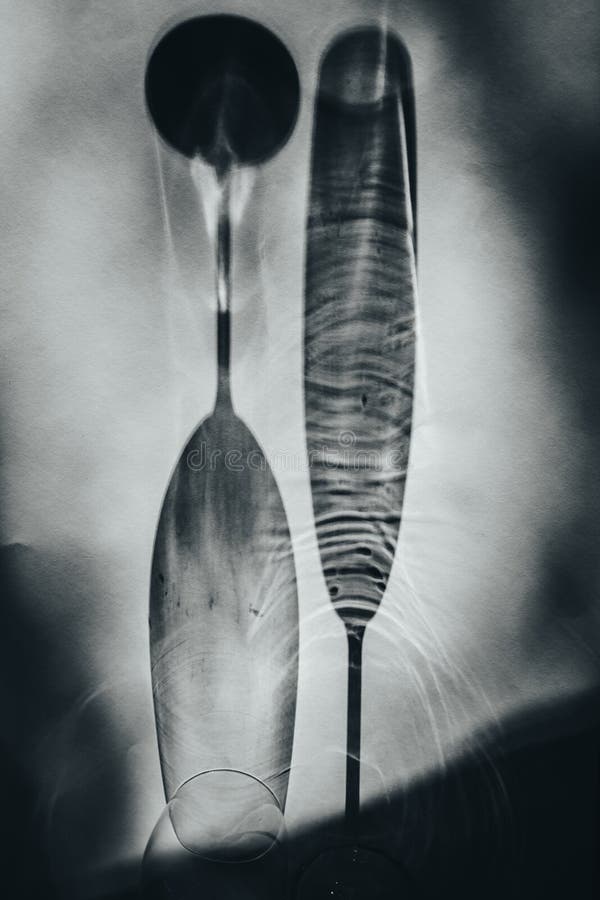 Glass Goblets Cast Beautiful Shadow and Beautiful Caustic Effect As ...