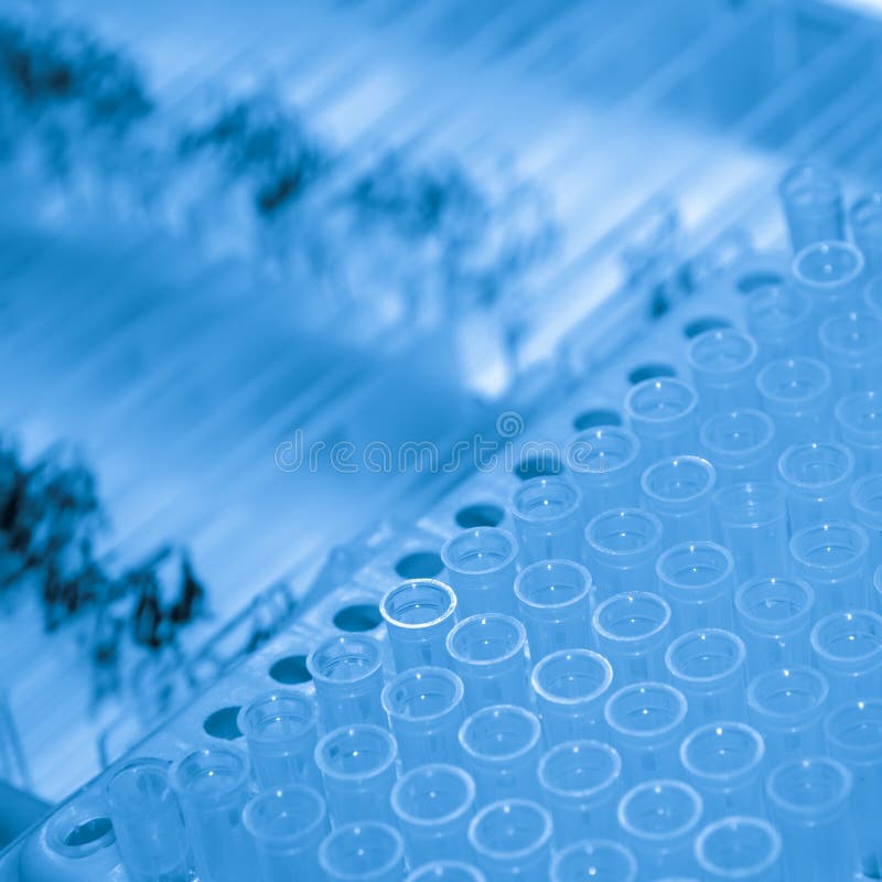 Microscope Slide Under Examination Stock Image - Image of slide, hold: 7087