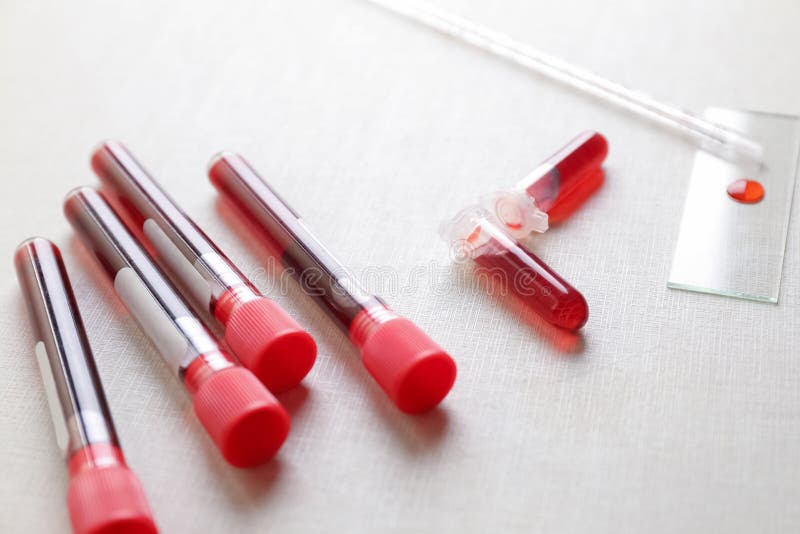 Glass and Test Tubes with Blood Samples on Table Stock Photo - Image of ...