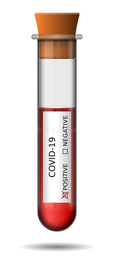 Glass Tube, Blood Sample Test Coronavirus Stock Illustration ...