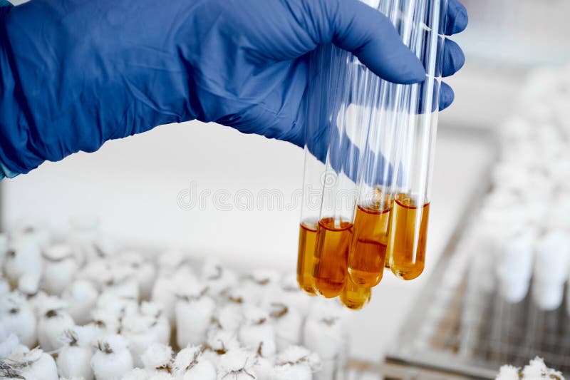 Glassware with Samples for Working on Bacterial Culture Stock Photo ...