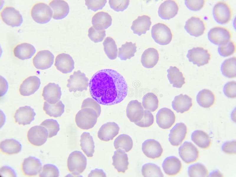 Globule blanc photo stock. Image du contrôle, cellule - 97101654