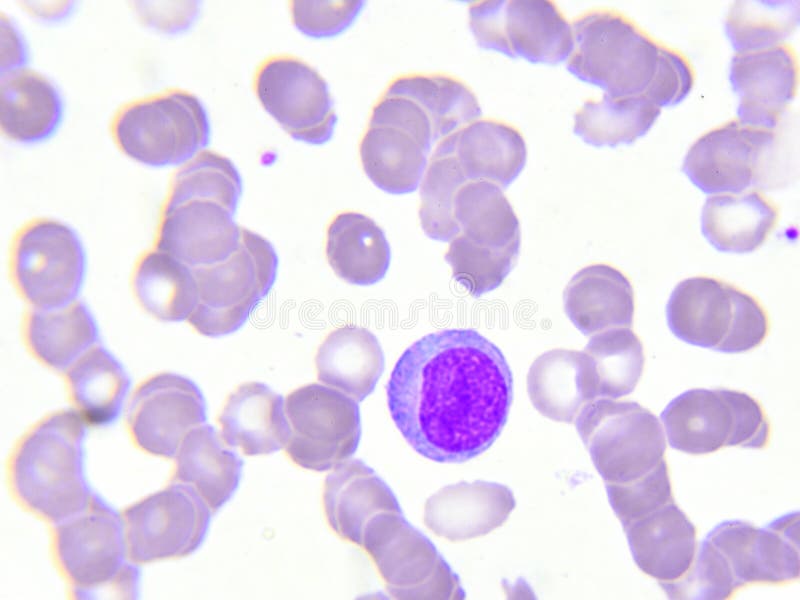 Globule blanc image stock. Image du plaquette, analysez - 97102045