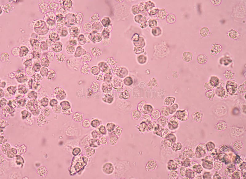 Globules Blancs Modérés, Globules Rouges, Cellules De Bactéries Dans L ...