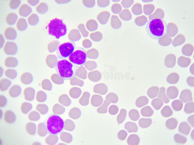 Globules blancs normaux photo stock. Image du contrôle - 93637908