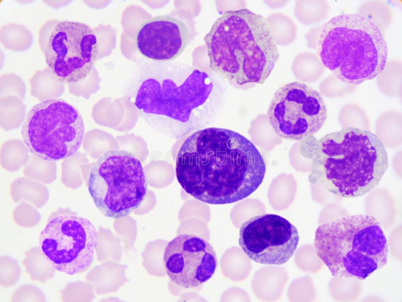 Globules Rouges Dans La Calomnie De Sang Image stock - Image du rouge ...