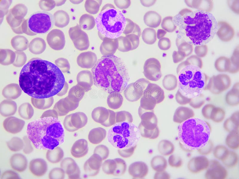 Globules blancs normaux photo stock. Image du soin, échantillon - 96830922