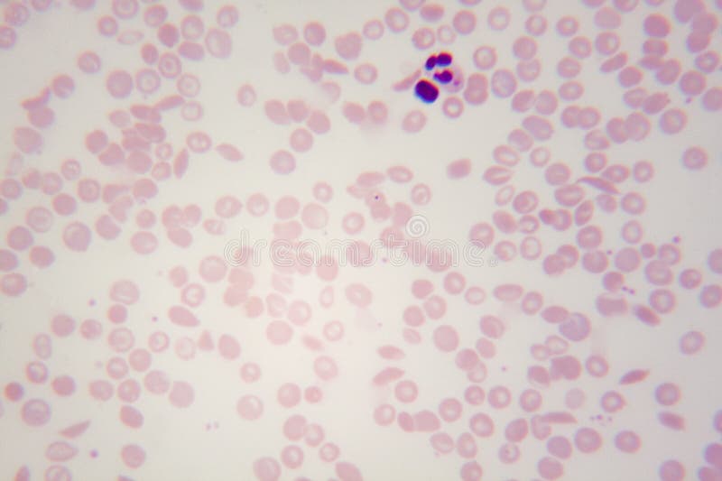 Globules rouges image stock. Image du médecine, clinique - 14146963