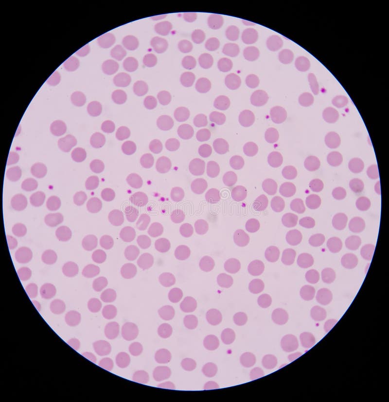 Fond Normal De Globules Rouges Image stock - Image du cellule ...