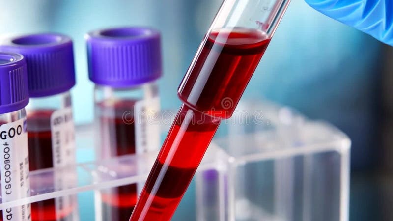 Blood Sample in Test Tubes for Medical Analysis in Laboratory Setting ...