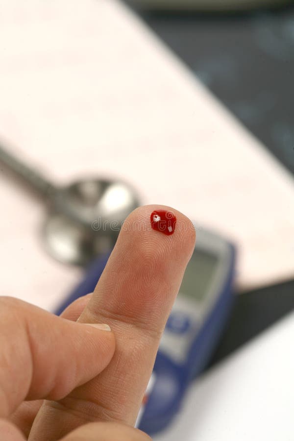 Glucose measurement stock image. Image of analyzing, hands - 15561349