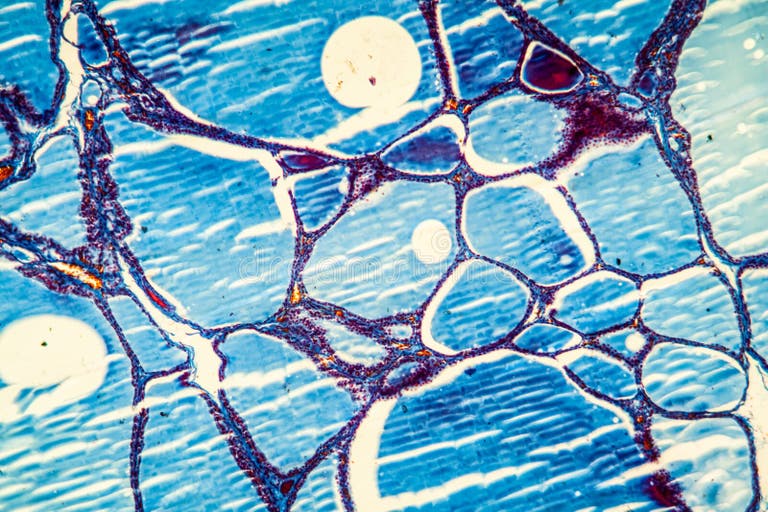 285 Colloid Scar Stock Photos - Free & Royalty-Free Stock Photos from ...