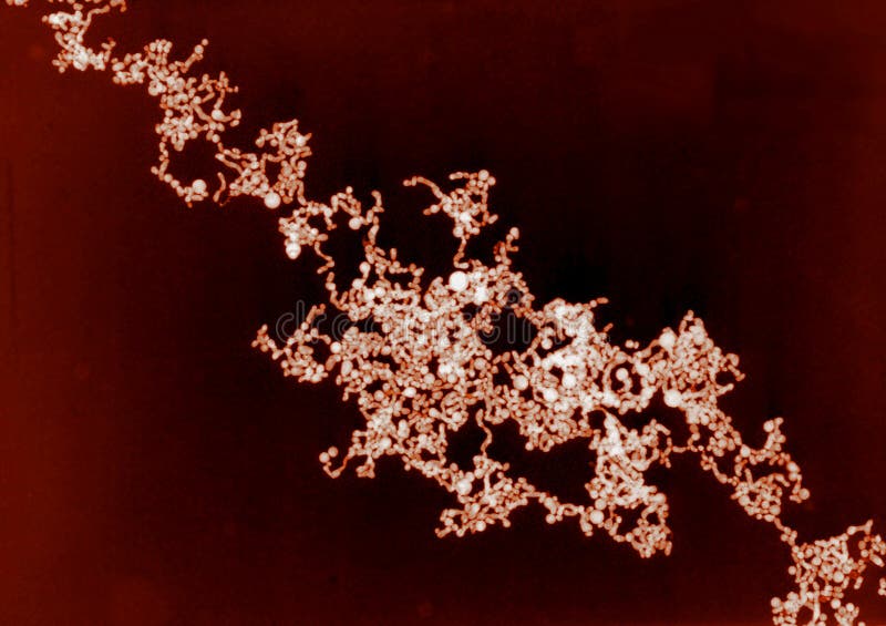 Small Gold Nanoparticles Seen with an Electron Microscope Stock Photo ...