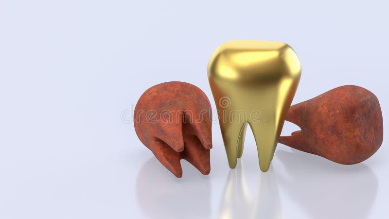 The Gold Teeth for Dental Concept 3d Rendering Stock Illustration ...