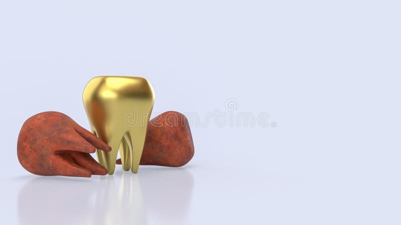The Gold Teeth for Dental Concept 3d Rendering Stock Illustration ...