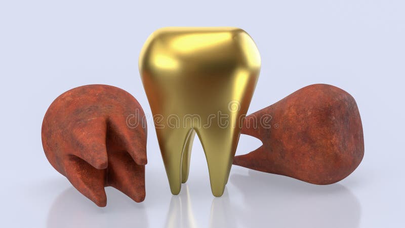 The Gold Teeth for Dental Concept 3d Rendering Stock Illustration ...