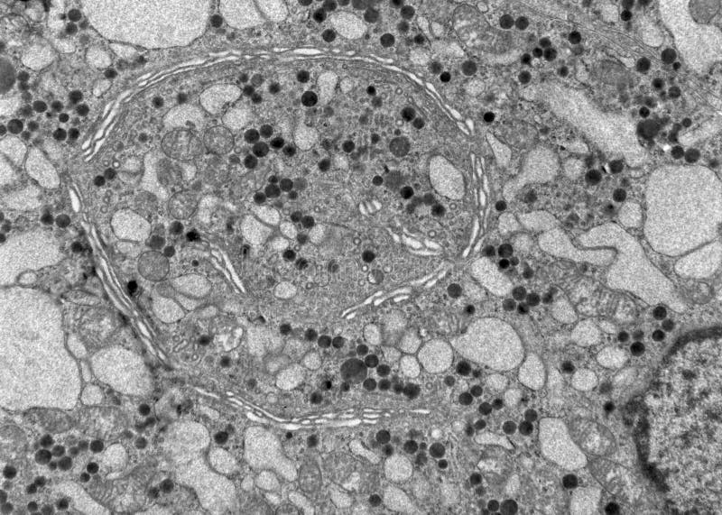 Golgi Apparatus. Gonadotropic Cell. TEM Stock Photo - Image of ...