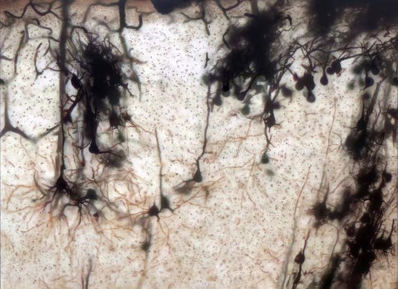 Golgi stain, brain stock image. Image of fragments, neurons - 327438287