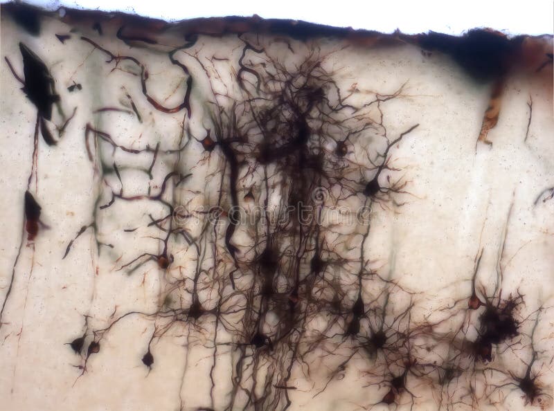 Golgi stain, brain stock photo. Image of visualized - 327439016