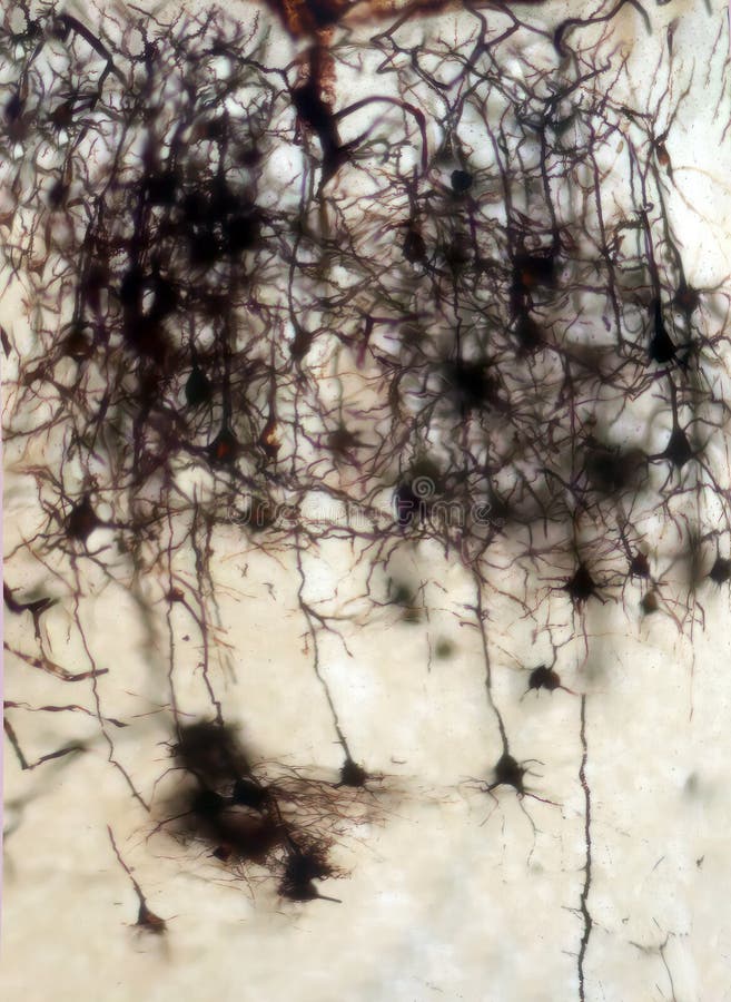 Golgi stain, brain stock image. Image of microscopy - 327438693