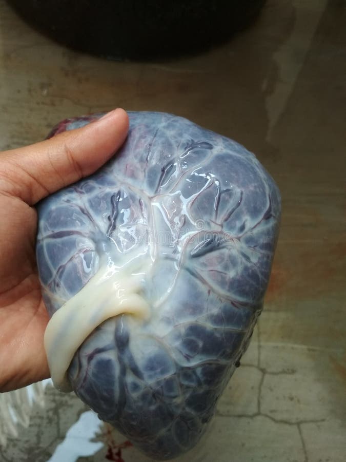 Good and Healthy Placenta stock photo. Image of finger - 261590430