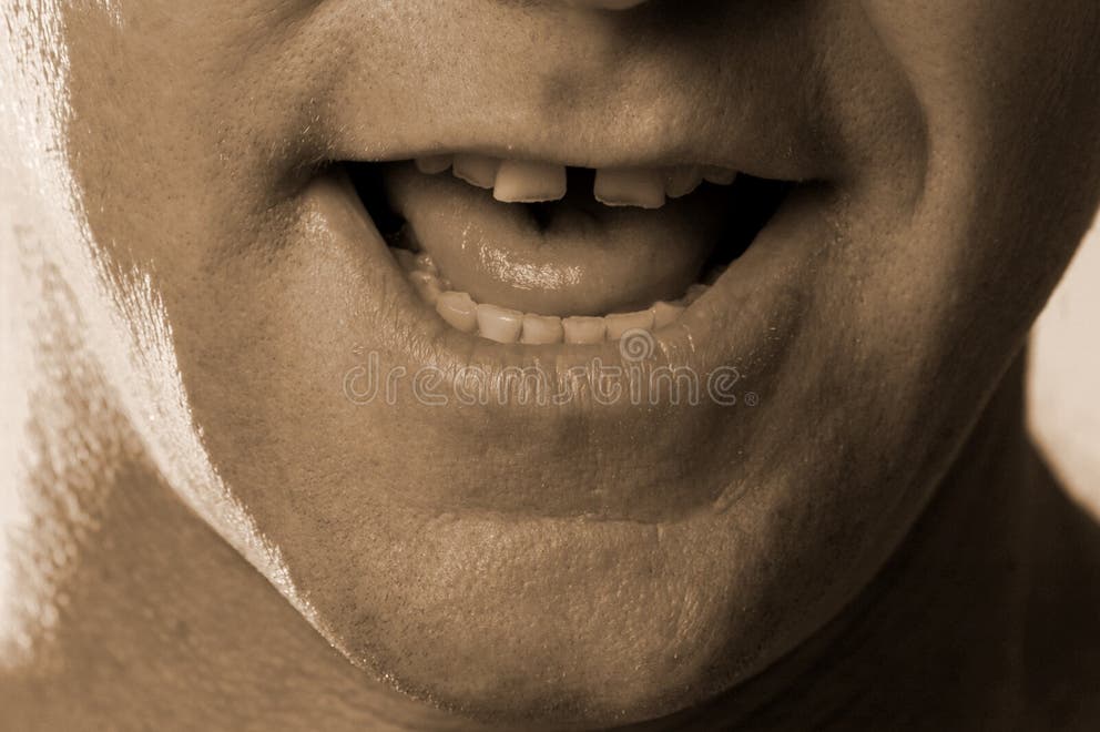 Goofy smile stock image. Image of male, goofy, veneers - 609999