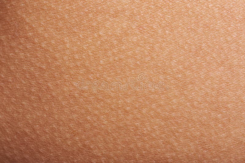 Goose bumps on human skin stock photo. Image of goosebumps - 84142742