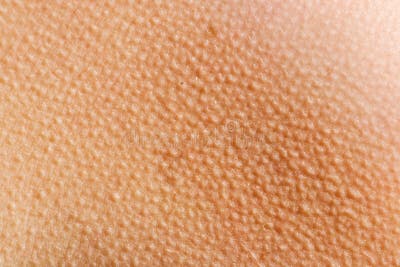 Goosebumps Skin Background stock photo. Image of goosebump - 6112842