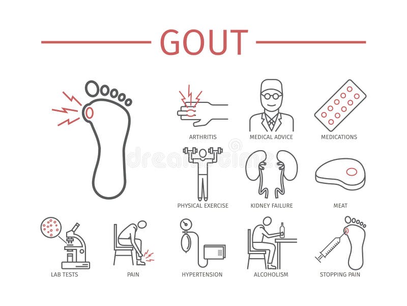 Gout Stock Illustrations – 1,266 Gout Stock Illustrations, Vectors ...