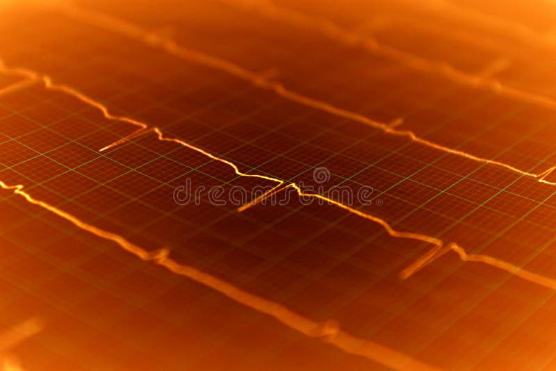 Elettrocardiogramma Su Carta Immagine Stock - Immagine di sano ...