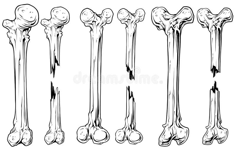 Grafische Zwart-witte Gebroken Beenderen Vectorreeks Vector Illustratie ...