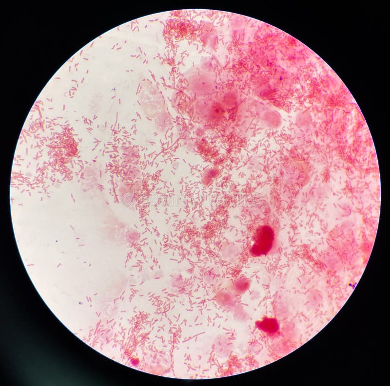 Gram Neagtive Bacilli on Slide Stock Image - Image of healthy ...