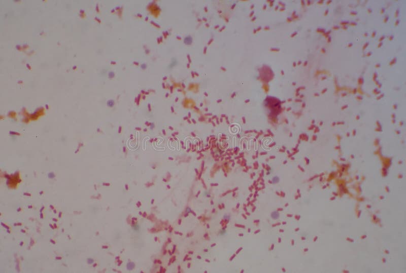 Gram Neagtive Rod in Urine Sample Stock Photo - Image of infection ...