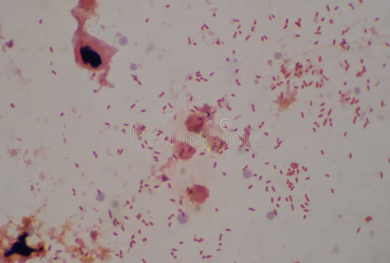 Gram Neagtive Rod in Urine Sample Stock Photo - Image of infection ...