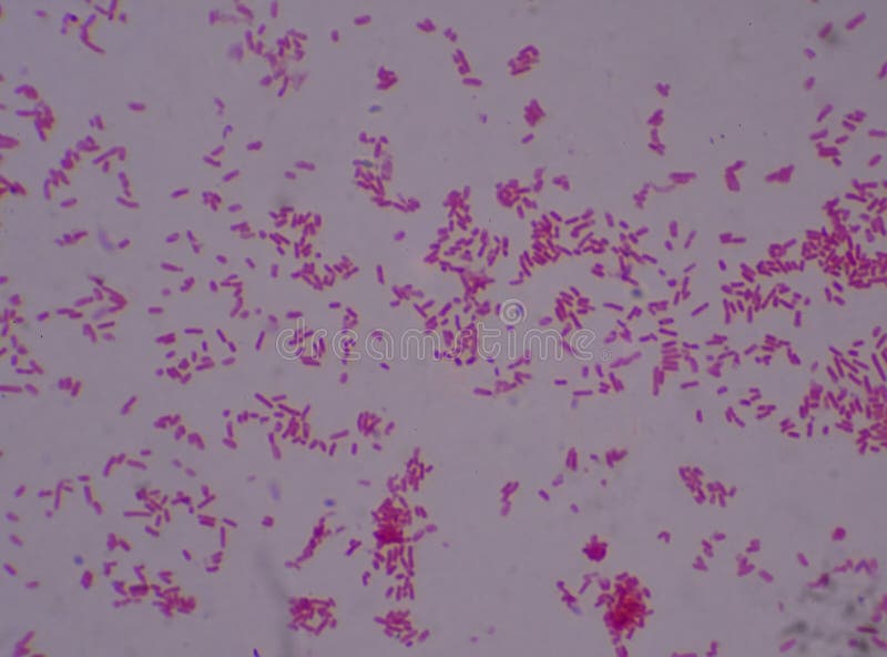 Gram Negative Bacilli E Coli