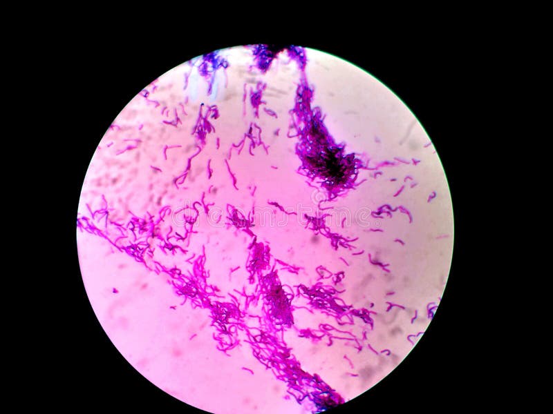 Gram Negative Diplococi Bacteria Neisseria Spp Stock Image - Image of ...