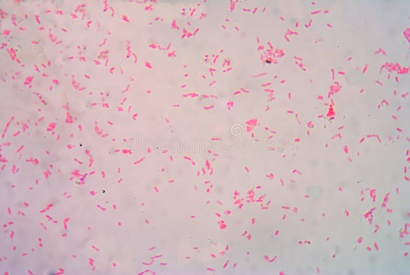 Gram Negative Diplococci Intracellular Stock Image - Image of ...