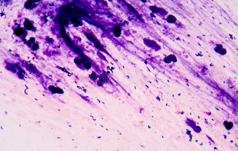 Gram Positive Bacilli Bacteria. Stock Photo - Image of human, medical ...