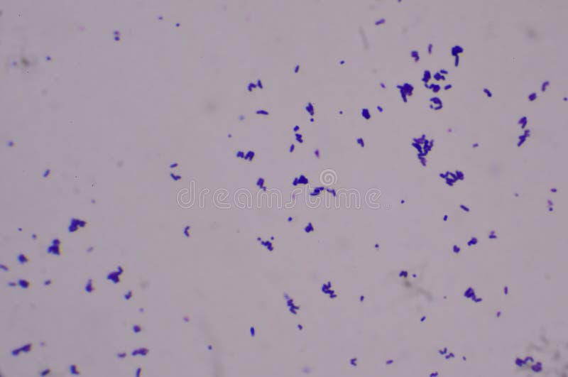 Gram Positive Cocci Finding with Microscope Stock Image - Image of ...