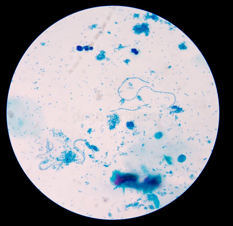 Gram positive cocc. stock photo. Image of care, gram - 65634746
