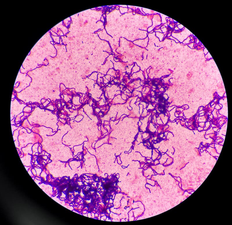 Gram Negative Rods In Chains