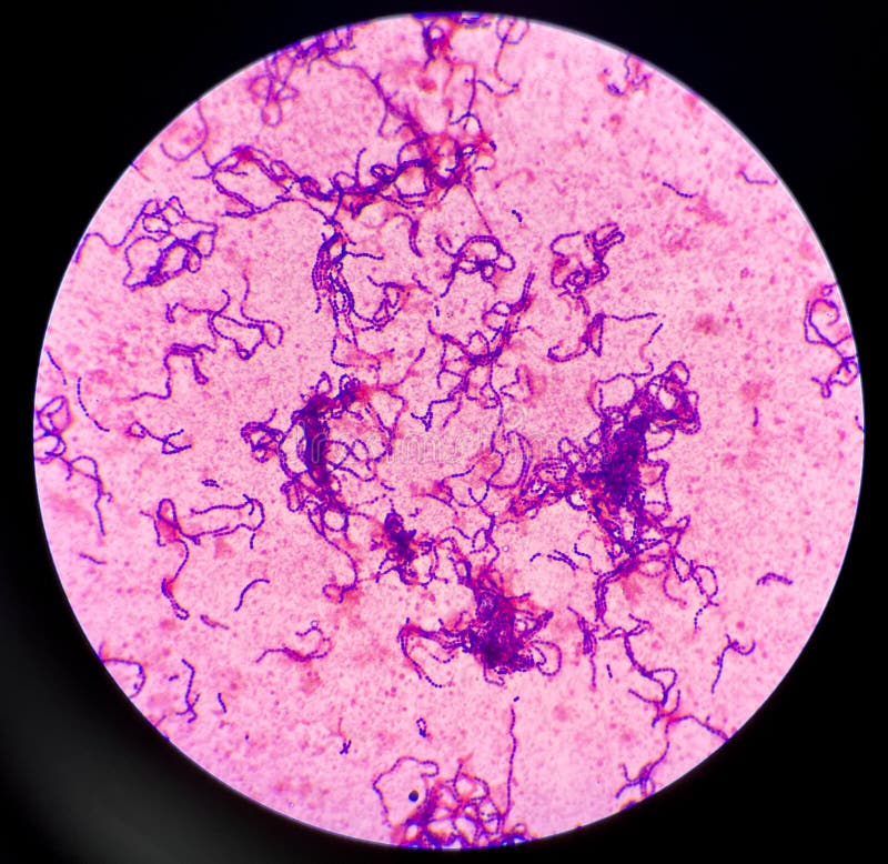 Gram Positive Cocci Clusters In 3d