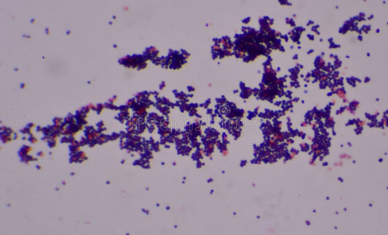 Gram Positive Cocci Finding with Microscope Stock Image - Image of ...