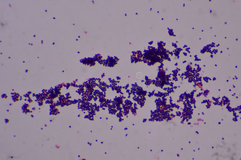 Gram Positive Cocci In Pairs