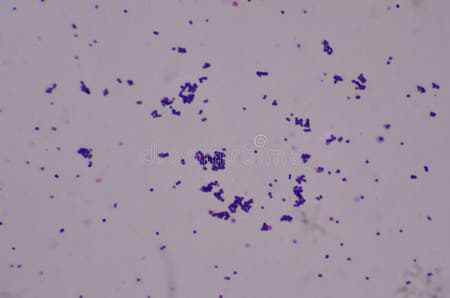 Gram Positive Cocci Finding with Microscope Stock Image - Image of ...