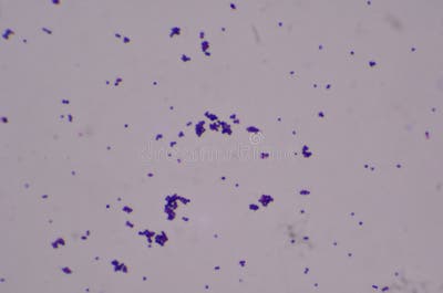Gram Positive Cocci Finding with Microscope Stock Photo - Image of ...
