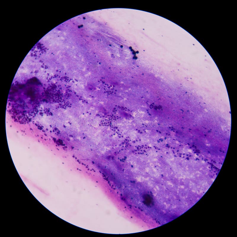 Gram Positive Bacilli Bacteria. Stock Photo - Image of microbiology ...